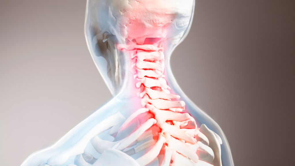 Benefits of Cervical Spine Injections | Southeast Pain & Spine Care